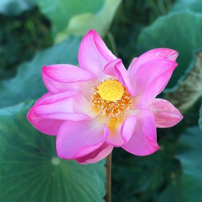 Illdefine Erythematous Itchy Rash Popliteal Fossa Stock Photo ...