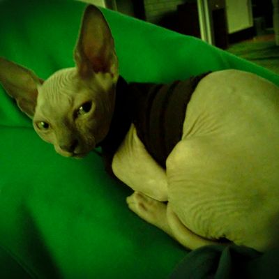 Stasis Mammary Gland Shown Under Microscope Stock Footage Video (100% ...