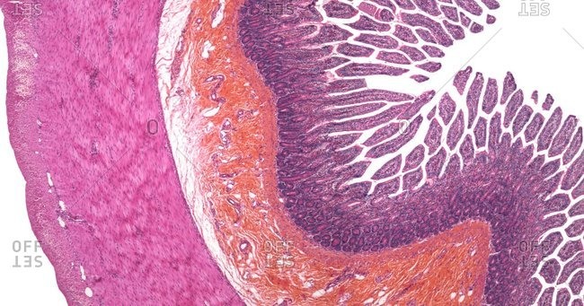 Transverse Section Of Ileum