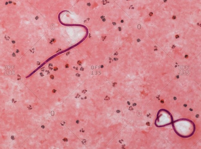 Heart Worm Blood Smear
