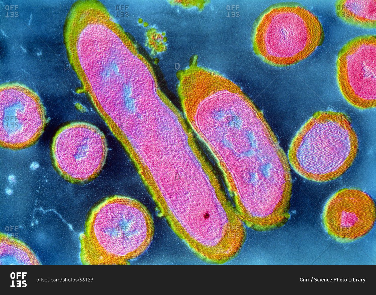 Erysipelothrix rhusiopathiae under a color transmission electron ...