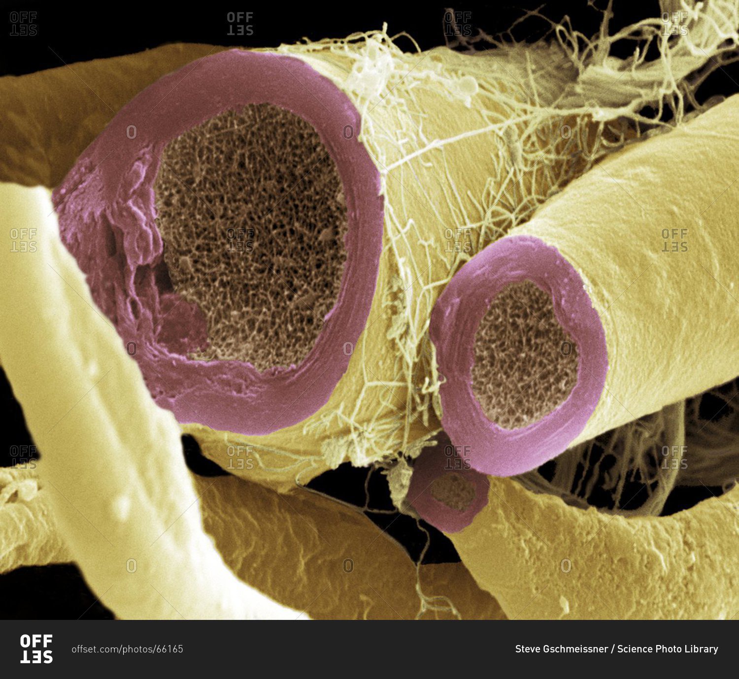 Magnification view of myelinated nerve fibers under a Color scanning ...