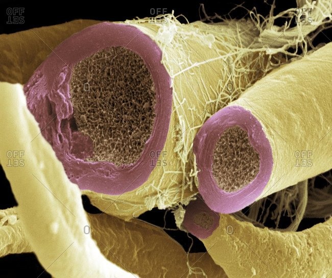 Magnification view of myelinated nerve fibers under a Color scanning ...