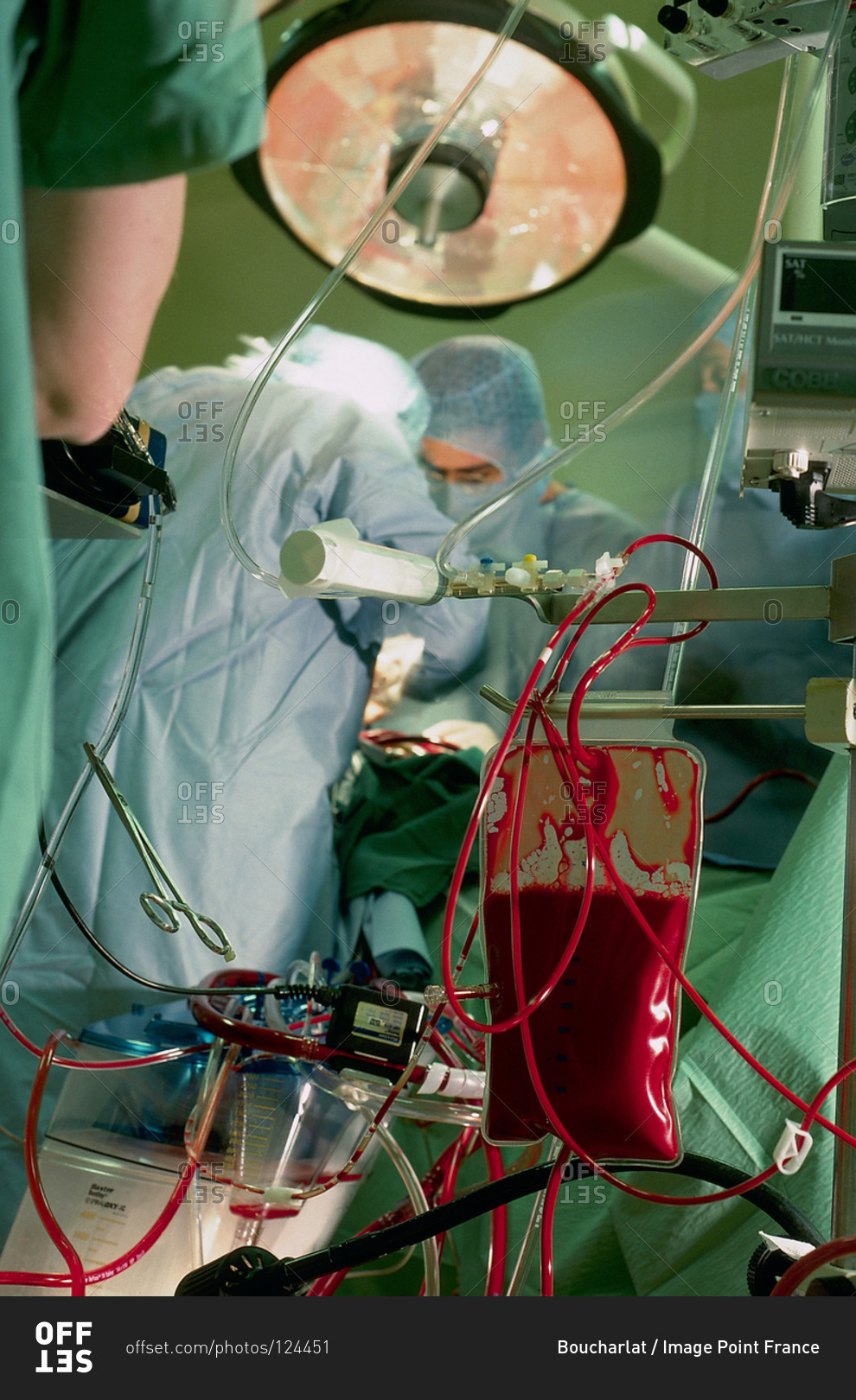 View of a Cardiopulmonary bypass, temporarily takes over the function ...