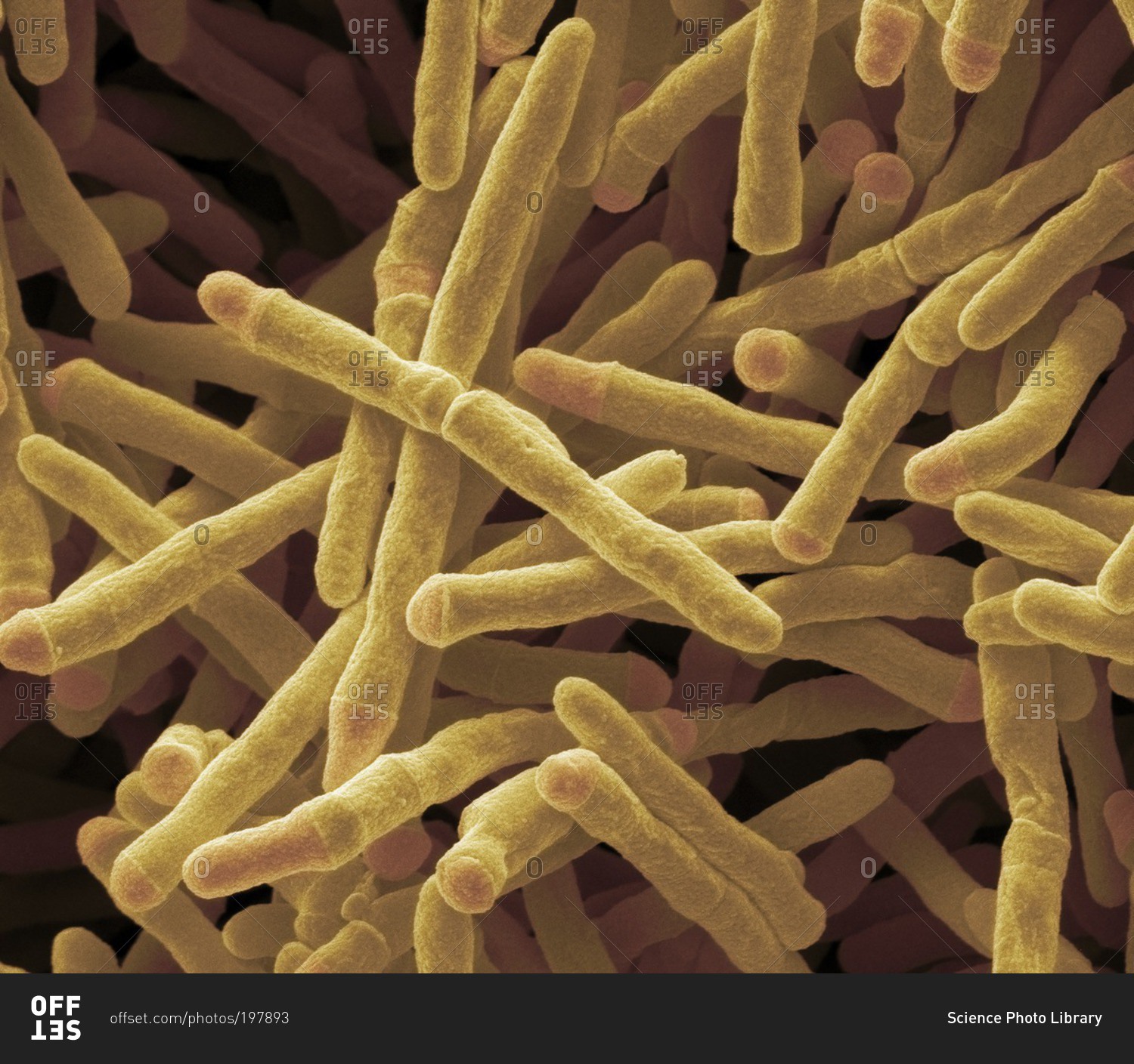 Close up of yellow Mycobacterium smegmatis bacteria stock photo - OFFSET