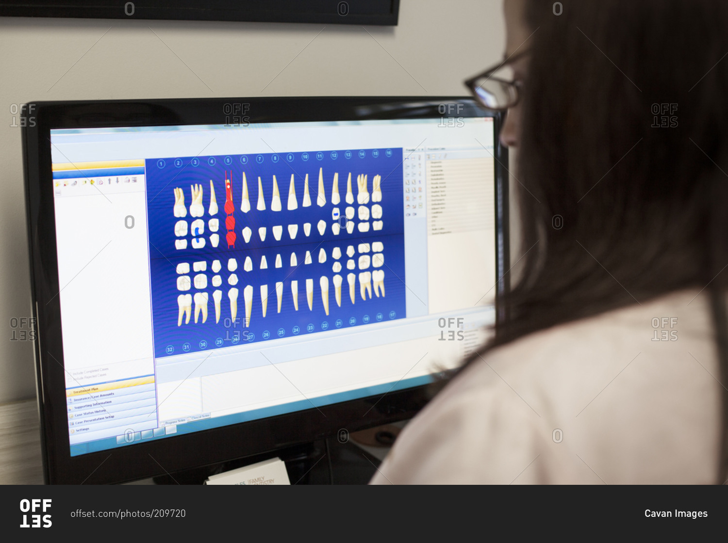 A dentist reviews teeth treatments on a computer - Stock Image - Everypixel