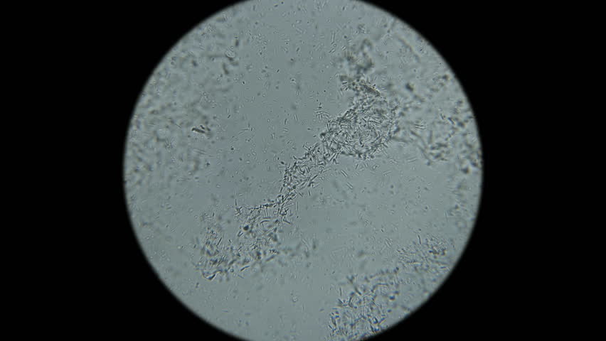 Cadaveric Decomposition Stock Video Footage - 4K and HD Video Clips ...