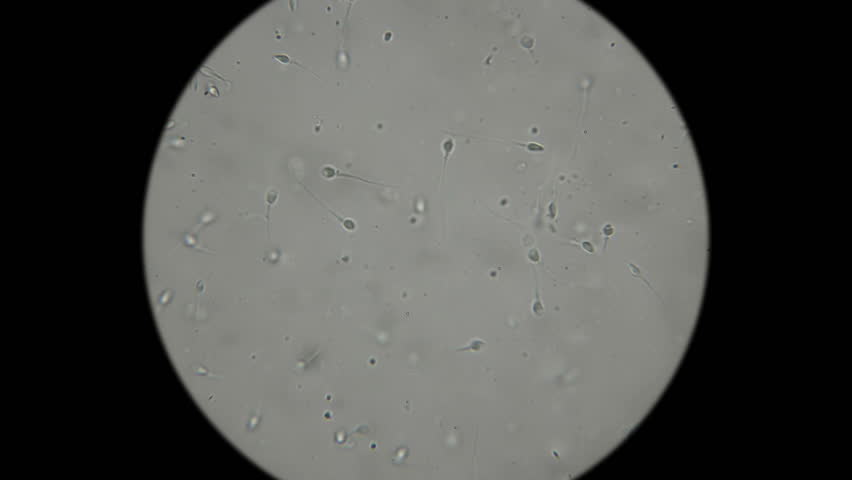 alive sperms dog on light microscope Stock Footage Video (100% Royalty ...