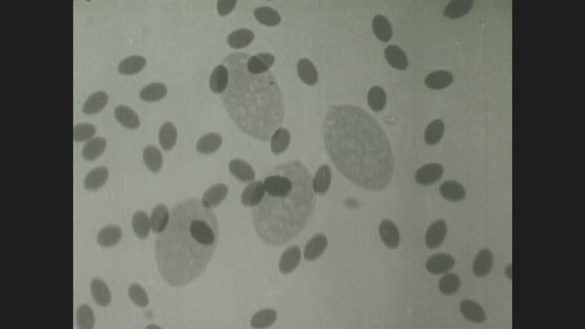 1940s: Tapeworm Eggs Under Microscope. Stock Footage Video (100% ...
