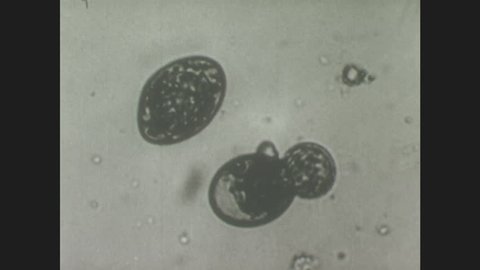 1940s Tapeworm Egg Under Microscope Hatches Stock Footage Video (100% ...