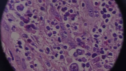 Fish Blood Cell Under Microscope Blood Stock Footage Video (100% ...