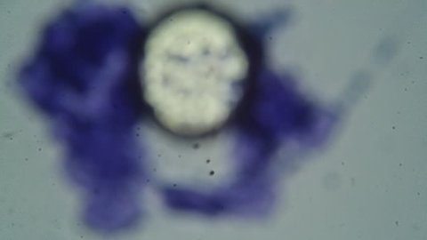 Cells Bacteria Microscope Colored Methylene Blue Stock Footage Video ...