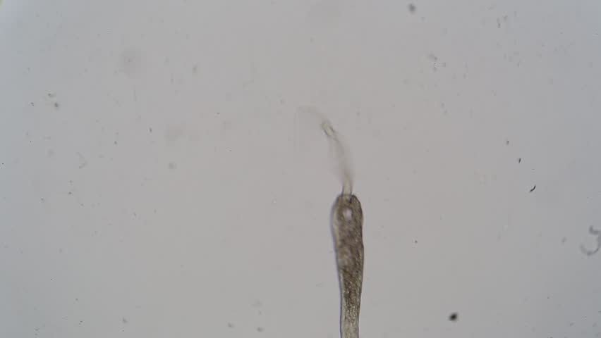 trematode cercaria larva freshwater fish under: วิดีโอสต็อก (ปลอดค่า ...