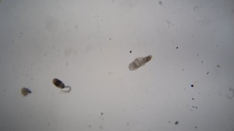 Trematode Cercaria Larva Freshwater Fish Under Stock Footage Video (100 ...