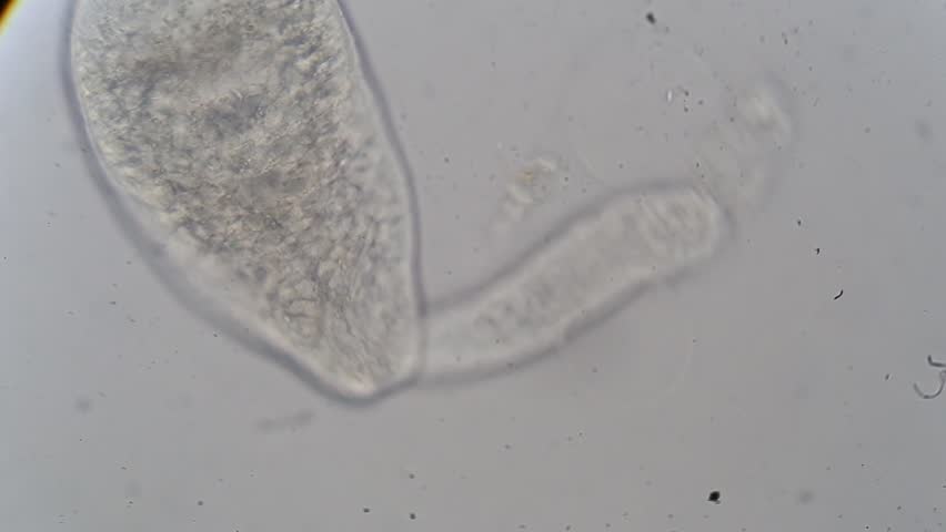 Trematode, Cercaria Larva in Freshwater Stock Footage Video (100% ...