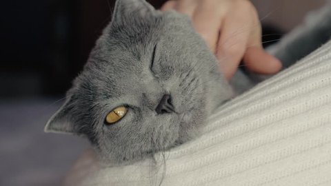 ringworm tinea capitis favus man examines Stock Footage Video (100% ...