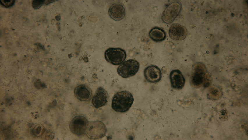 Amoeba shapes Stock Video Footage - 4K and HD Video Clips | Shutterstock