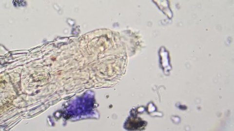Terrifying Creature Seen Under Microscope Stock Footage Video (100% ...