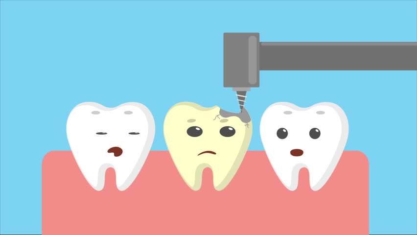 Broken Tooth Cartoon Stock Video Footage - 4K and HD Video Clips ...