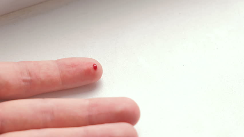 cut on finger man's hand blood Stock Footage Video (100% Royalty-free ...