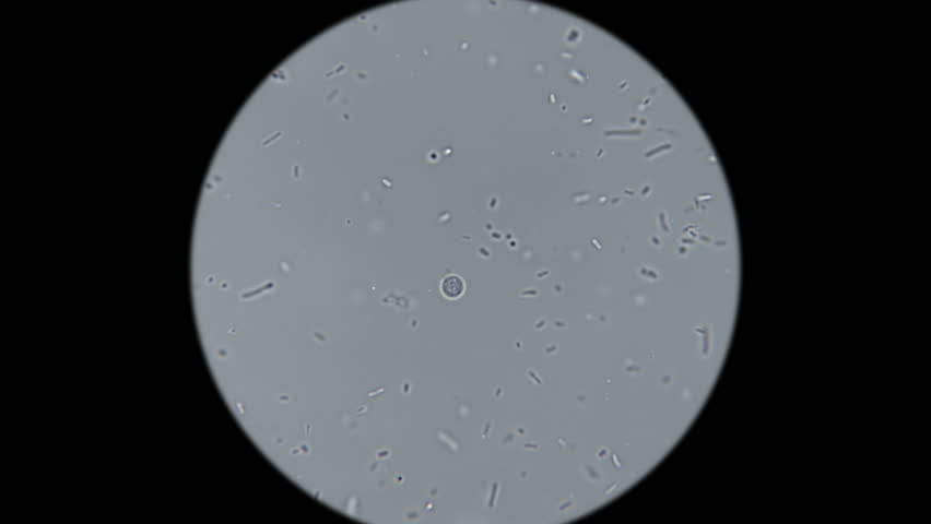 bacteria under microscope movement different types Stock Footage Video ...
