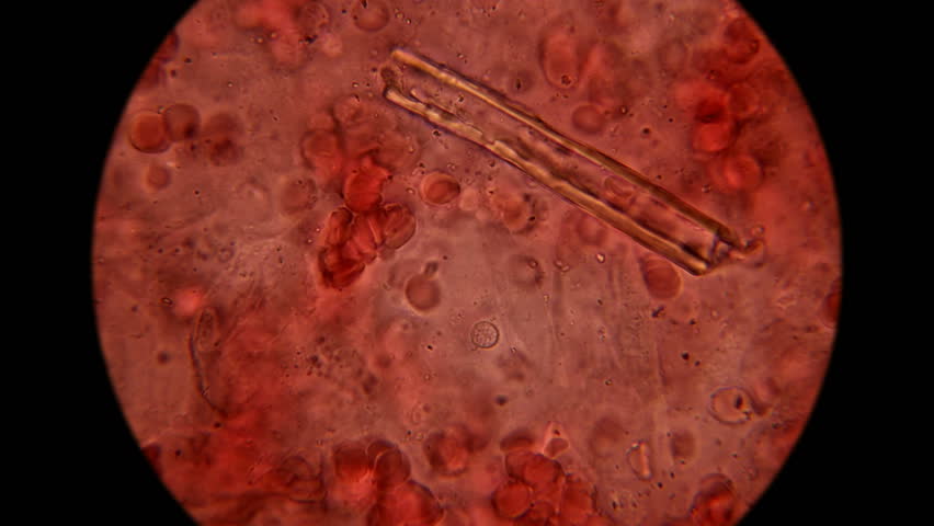 menstrual blood microflora bacteria under microscope Stock Footage ...