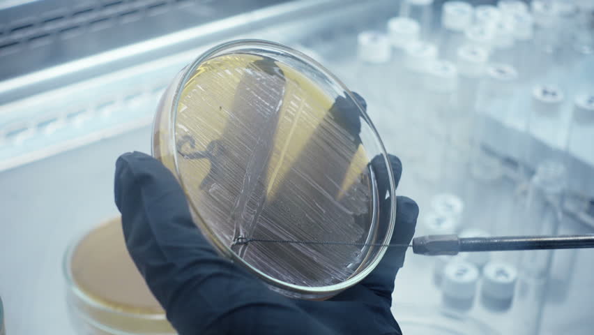 close-up microbiologist bacterial loop collects bacteria Stock Footage ...