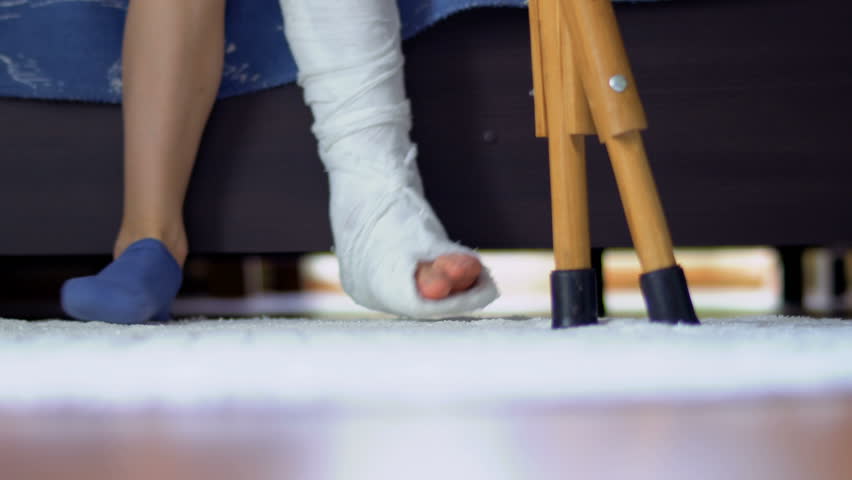 child broken leg crutches Stock Footage Video (100% Royalty-free ...