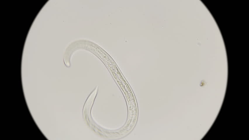 nematoda worm under microscope Stock Footage Video (100% Royalty-free ...