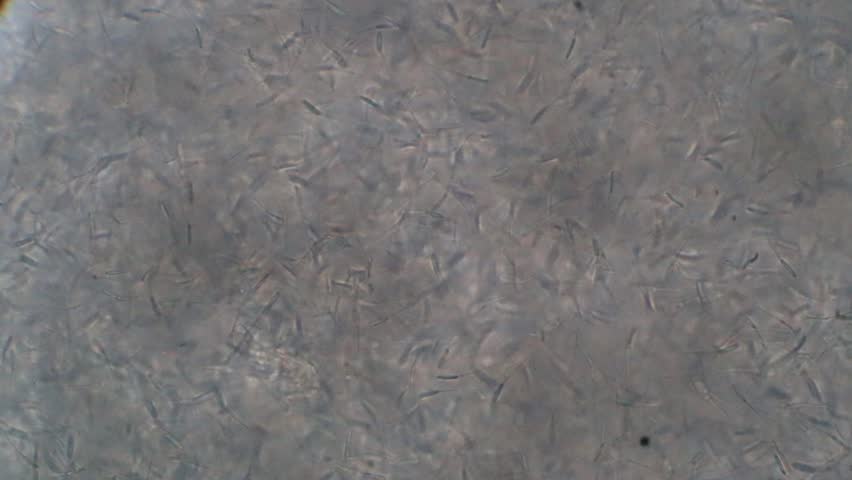 semen seminal fluid pig under microscope: วิดีโอสต็อก (ปลอดค่าลิขสิทธิ์ ...