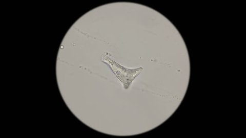 Basal Cell Nasal Mucosa Under Microscope Stock Footage Video (100% ...