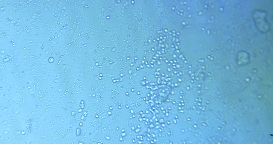 Spermatozoids Under the Microscope Stock Footage Video (100% Royalty ...