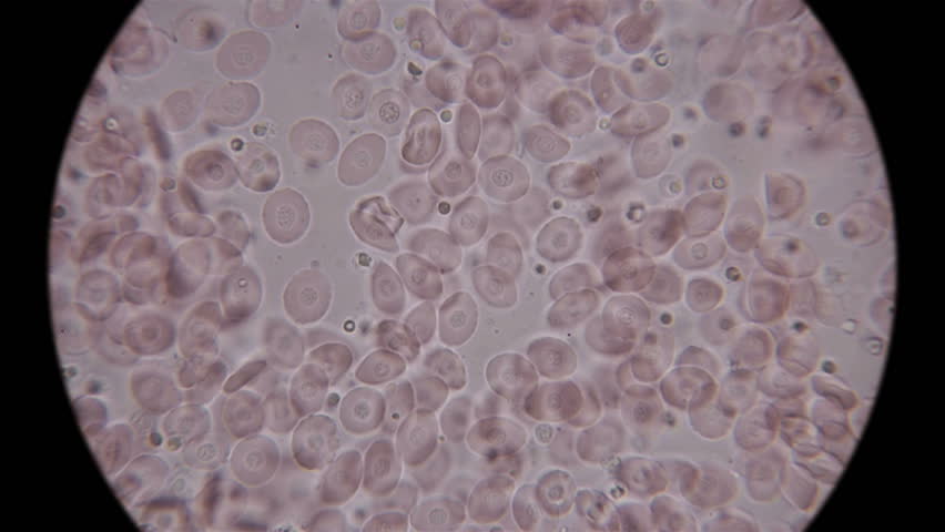 「Blood of a Fish Under」の動画素材（ロイヤリティフリー）1012150400 | Shutterstock