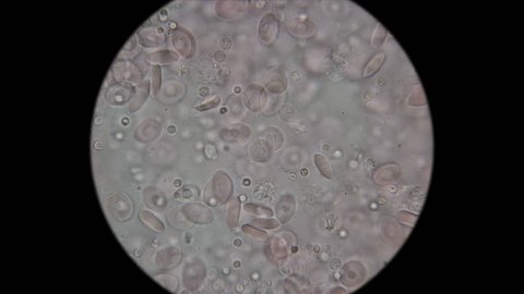yeast under microscope used baking bread Stock Footage Video (100% ...