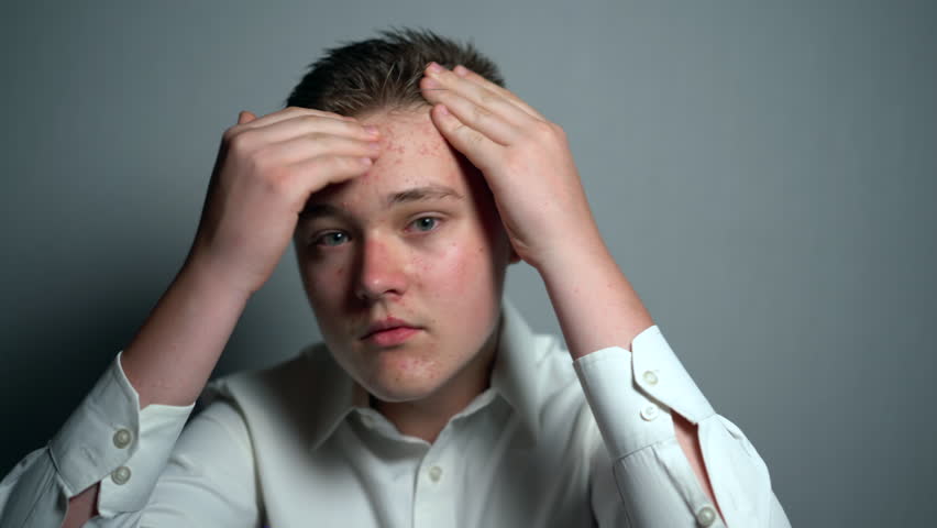 closeup man's face skin problems man Stock Footage Video (100% Royalty ...