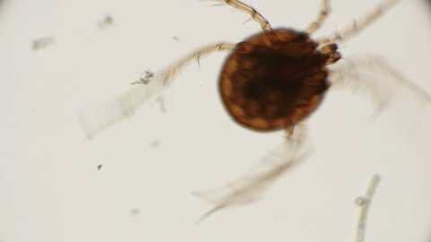 Mite Hydrachnidia Under Microscope Live Only Stock Footage Video (100% ...