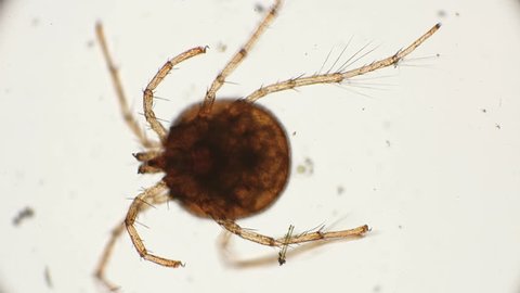 Water Mite Moving Legs Under Microscope Stock Footage Video (100% ...