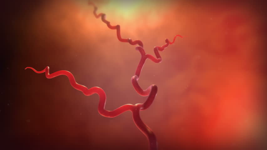 A Blood Vessel Bursting Stock Footage Video (100% Royalty-free ...