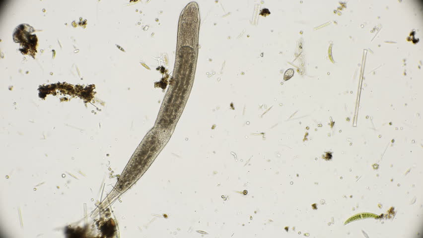 flat ciliated worm turbellaria under microscope Stock Footage Video ...