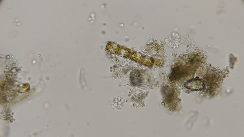 Synura Algae Causing Water Bloom Under Stock Footage Video (100% ...