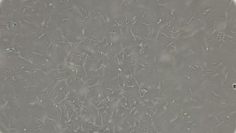 Colony Bacteria Spirochetes Under Microscope Stock Footage Video (100% ...