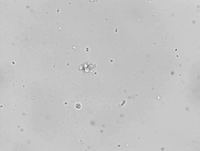 photomicroscopy activated sludge bacterial wastewater treatment Stock ...