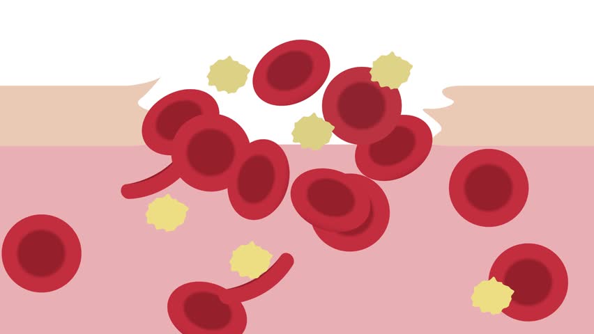 Platelet Fibrin On Wound Graphic Animation Stock Footage Video (100% ...