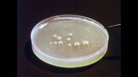 1960s Magnified Bacteria Wiggle On Microscope Stock Footage Video (100% ...
