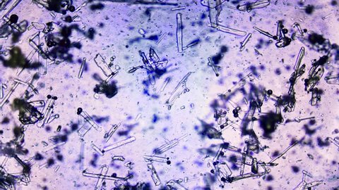 Salt Sugar Soda Filmed Under Microscope Stock Footage Video (100% ...