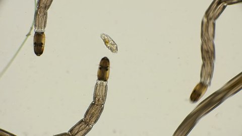 Larva Biting Midges Family Keratopogonidae Under Stock Footage Video ...