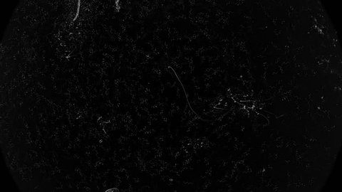 Colony Bacteria Spirochetes Under Microscope Stock Footage Video (100% ...