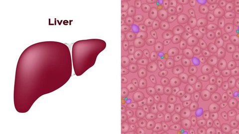 Normal Liver Fatty Liver Cirrhosis Liver Stock Footage Video (100% ...