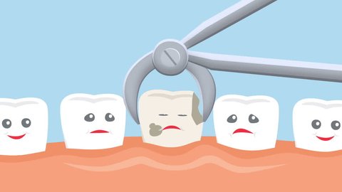 Cartoon Tooth Extraction Dental Animation Reception Stock Footage Video ...