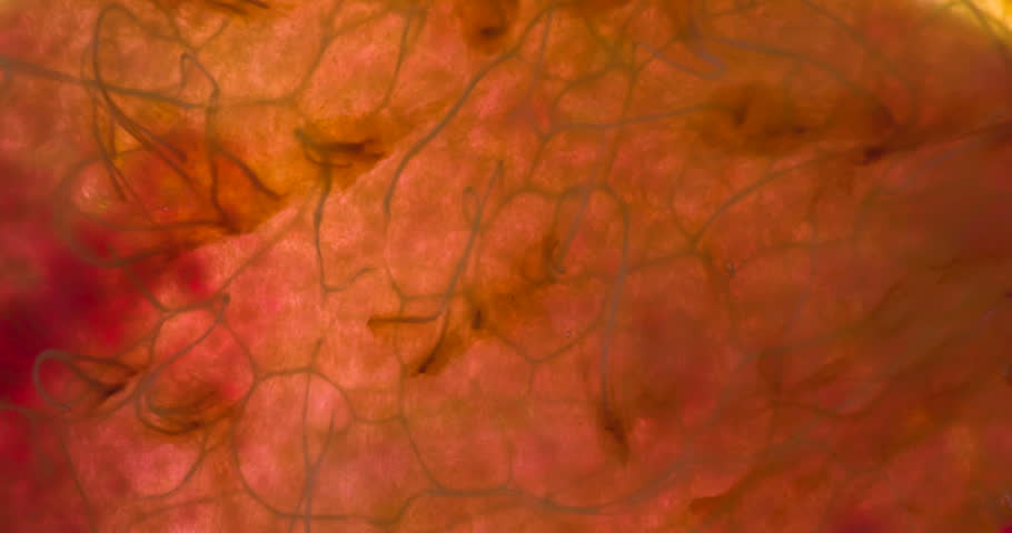 Retinal Vessels Under Microscope Stock Footage Video (100% Royalty-free ...